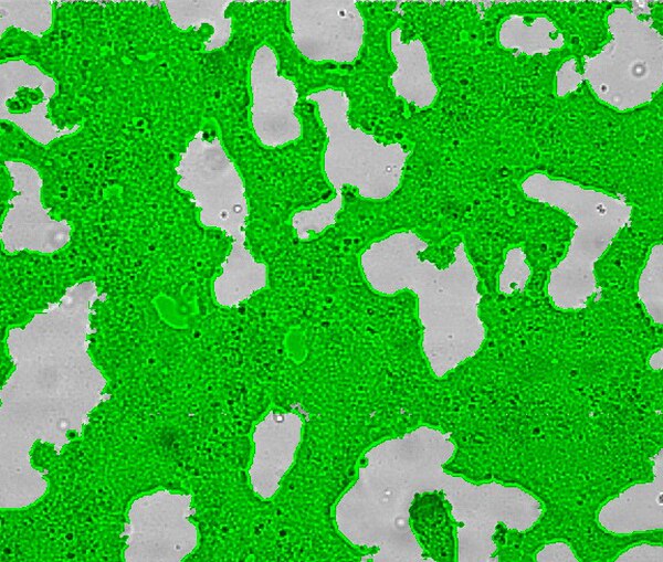 Mouse mammary tumor cell line TUBO | SCC222